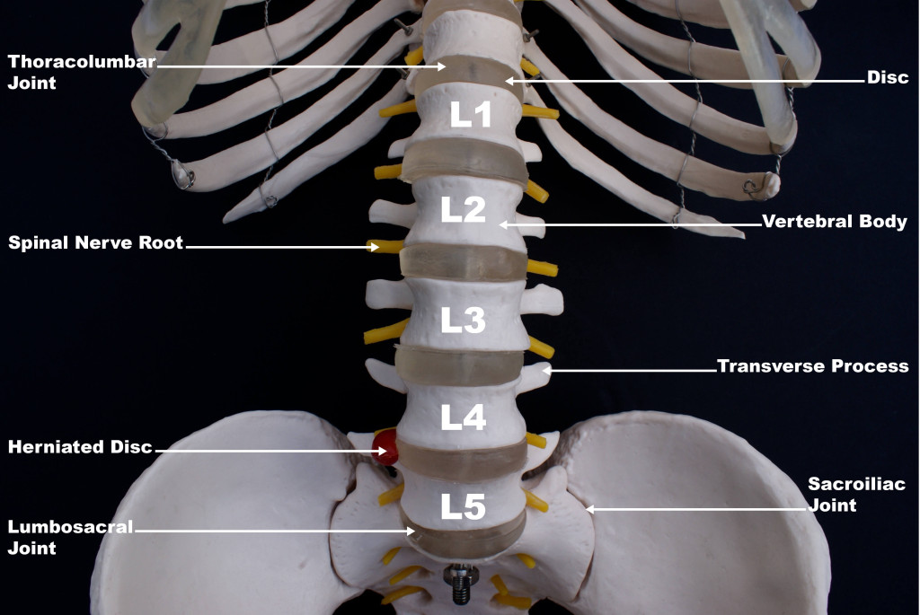 Lower Back (Lumbar) Spine Pain | Keystone Spine and Pain Management ...